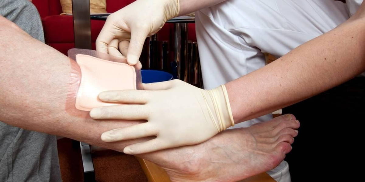 Slim AI-gedreven wondverband versnelt genezing | ICT&health