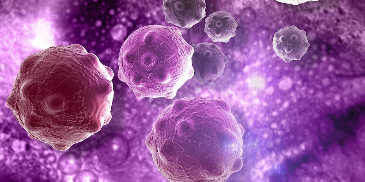 Real-time AI tumour analysis for personalised cancer care | ICT&health