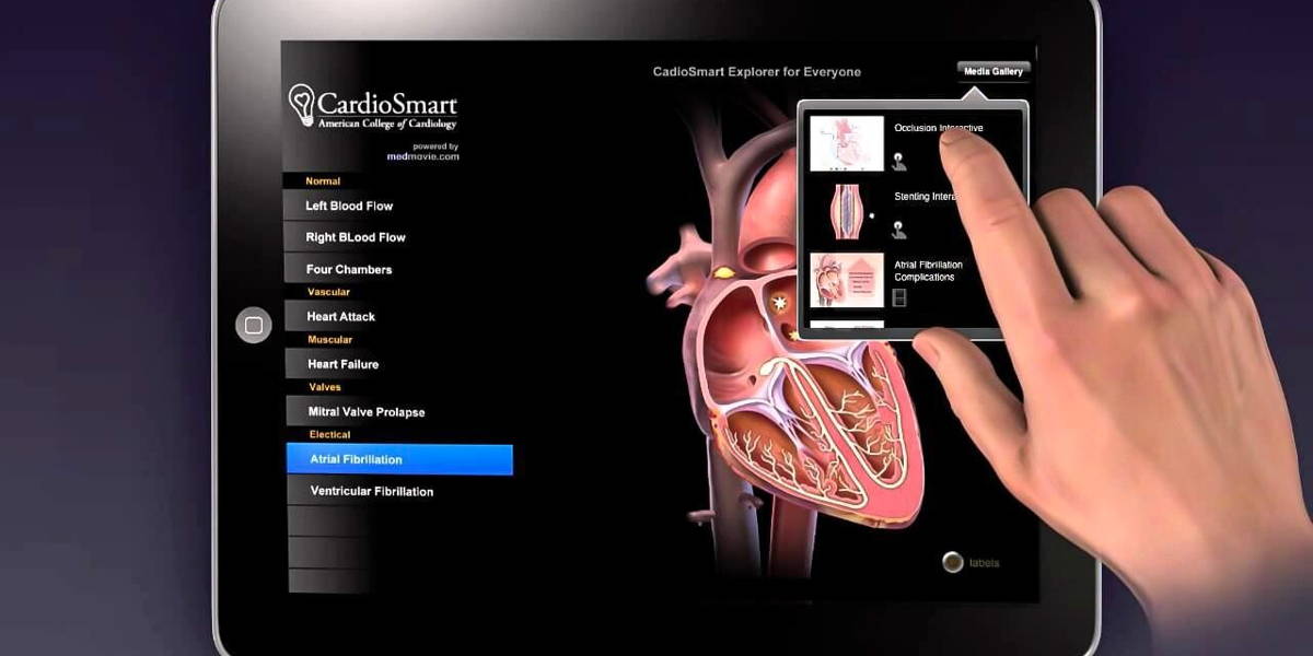 This App Allows To Visualize And Explain Common Heart Problems | ICT ...