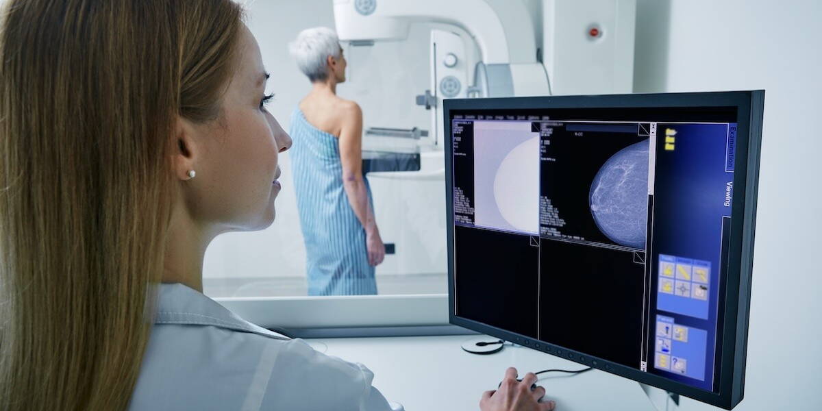 AI software for breast cancer risk receives “Breakthrough” status | ICT ...