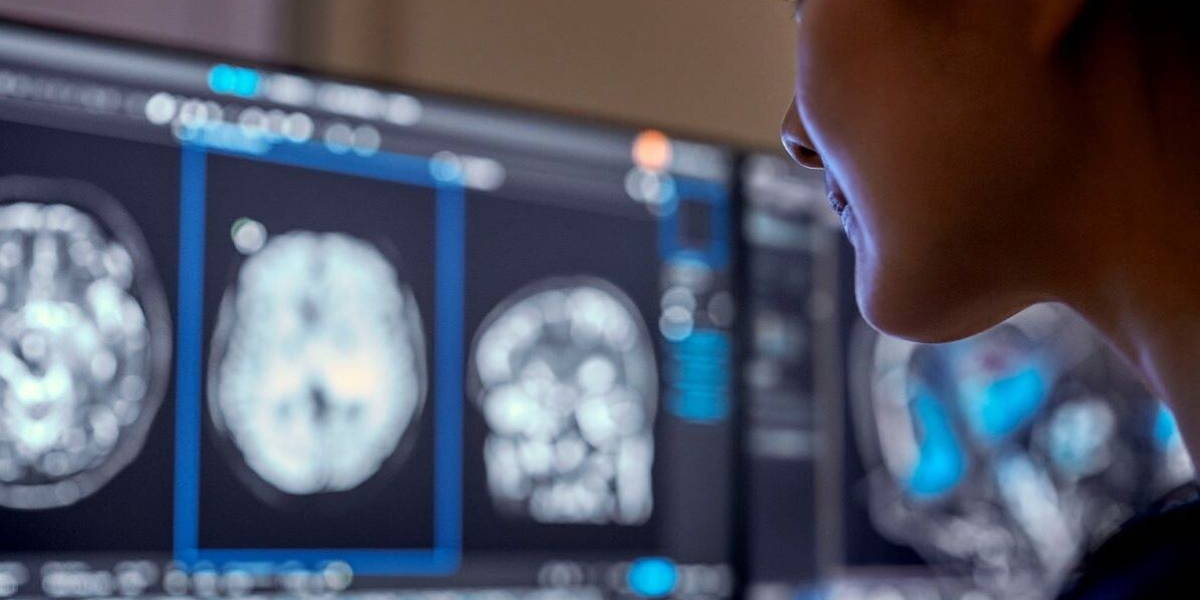 AI supports Australian radiologists with X-ray image analysis | ICT&health