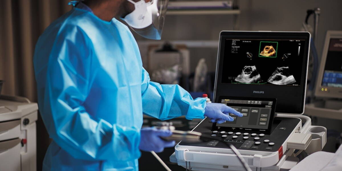 AI-driven ultrasound halves scan time in cardiac diagnostics | ICT&health