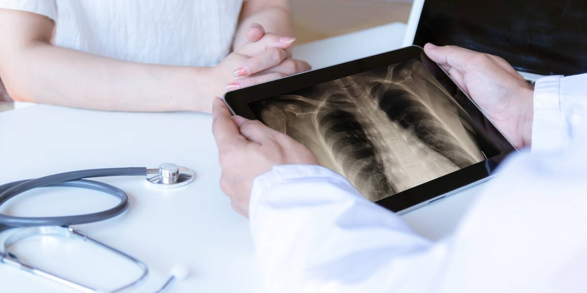 Longkanker sneller opsporen op CT-scans met AI | ICT&health