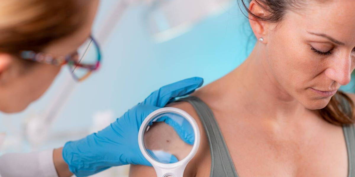 AI diagnostic platform improves early detection of skin cancer | ICT&health