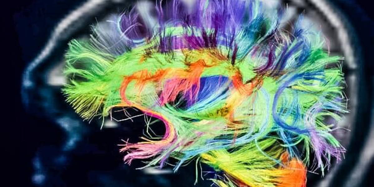 3d Printed Brain Like Environment Stimulates Neuron Growth At Tu Delft Archyde