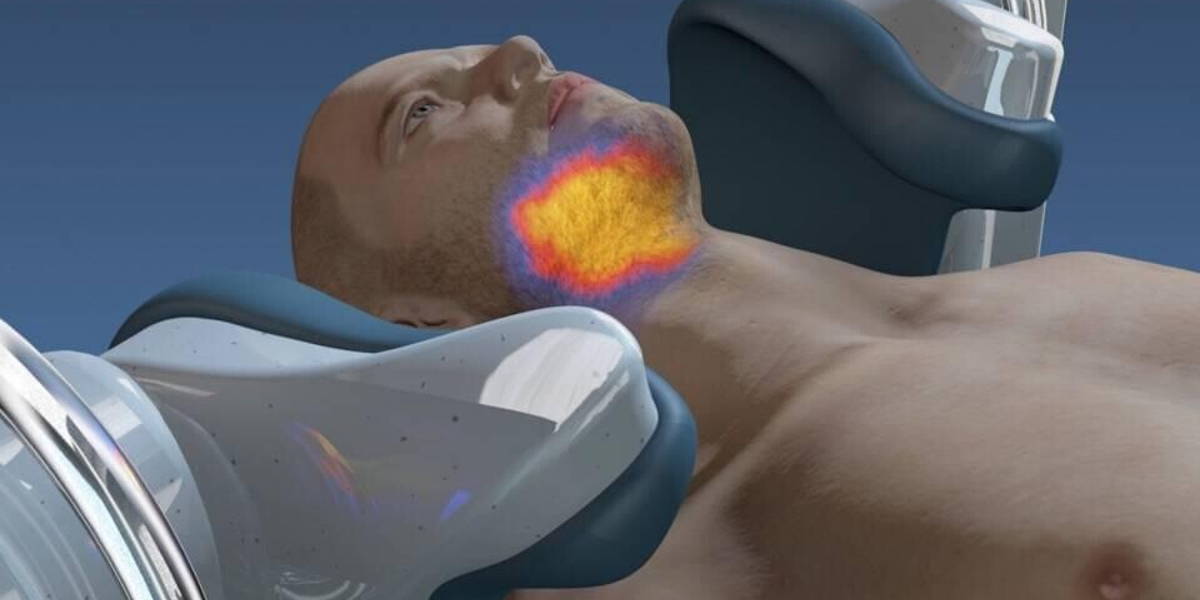 Erasmus MC en Sensius introduceren thermotherapie | ICT&health