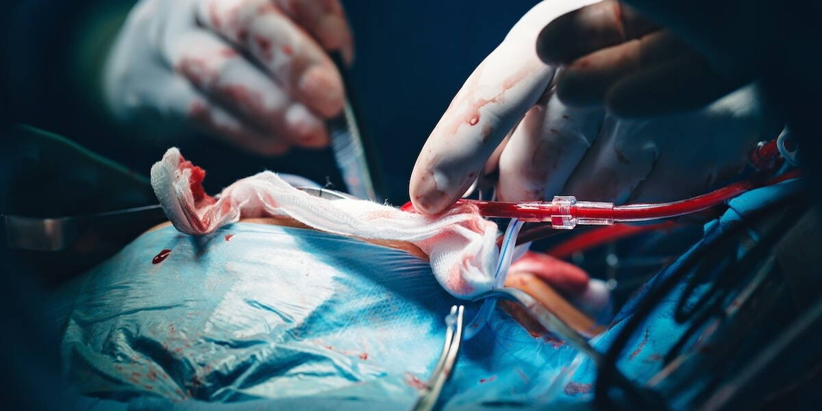 25 million for breakthrough in minimally invasive bypass surgery | ICT ...