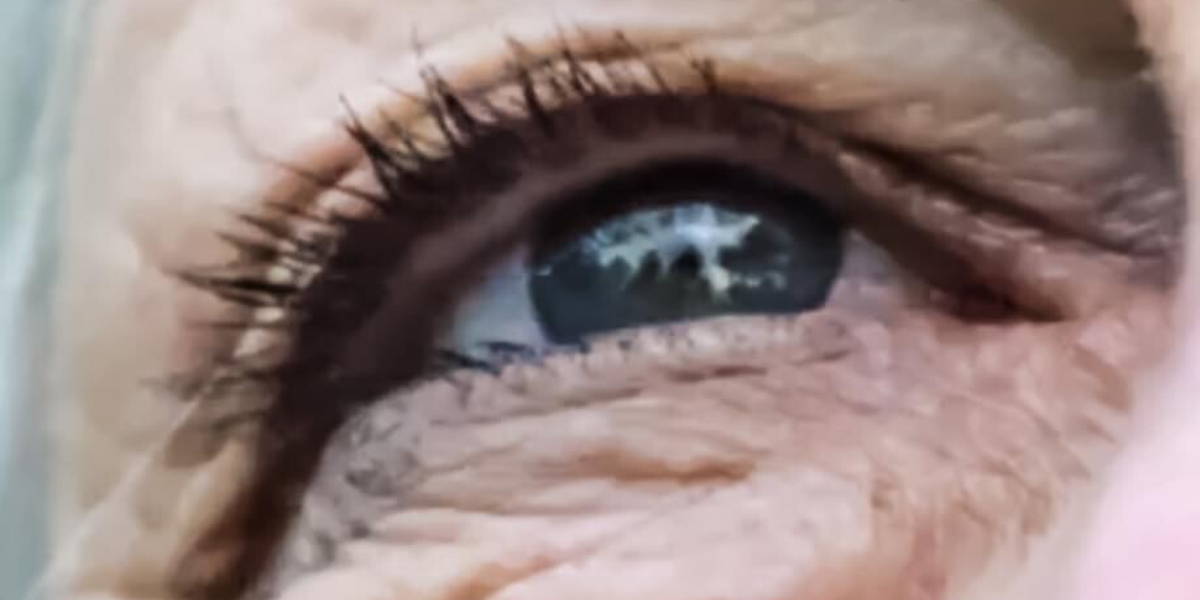 FDA approves CyPass Micro-Stent, an implant for Glaucoma | ICT&health