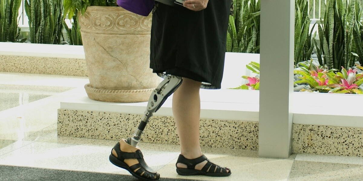 Sensoren in prothese-enkel zorgen voor evenwicht | ICT&health