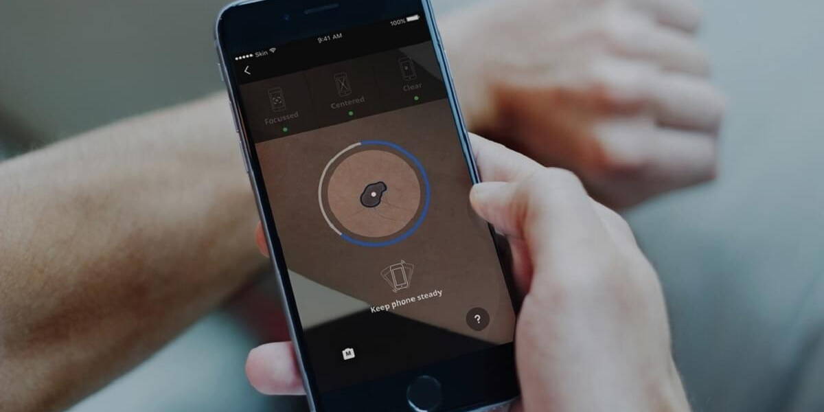 CZ wijst op succes SkinVision-app | ICT&health