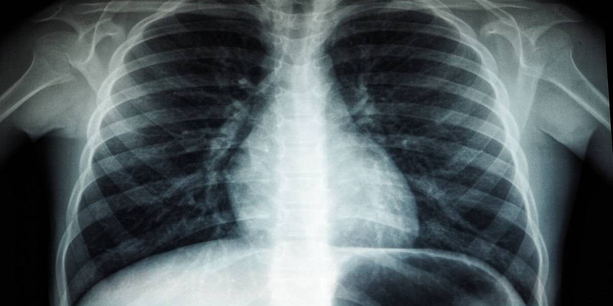 Röntgenstraling en nucleaire beeldvorming samenvoegen | ICT&health
