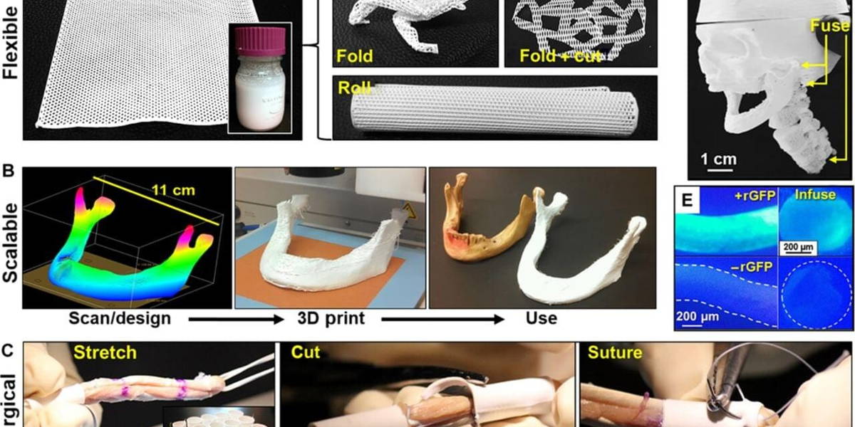 Repairing human bones with 3D printed synthetic replicas | ICT&health