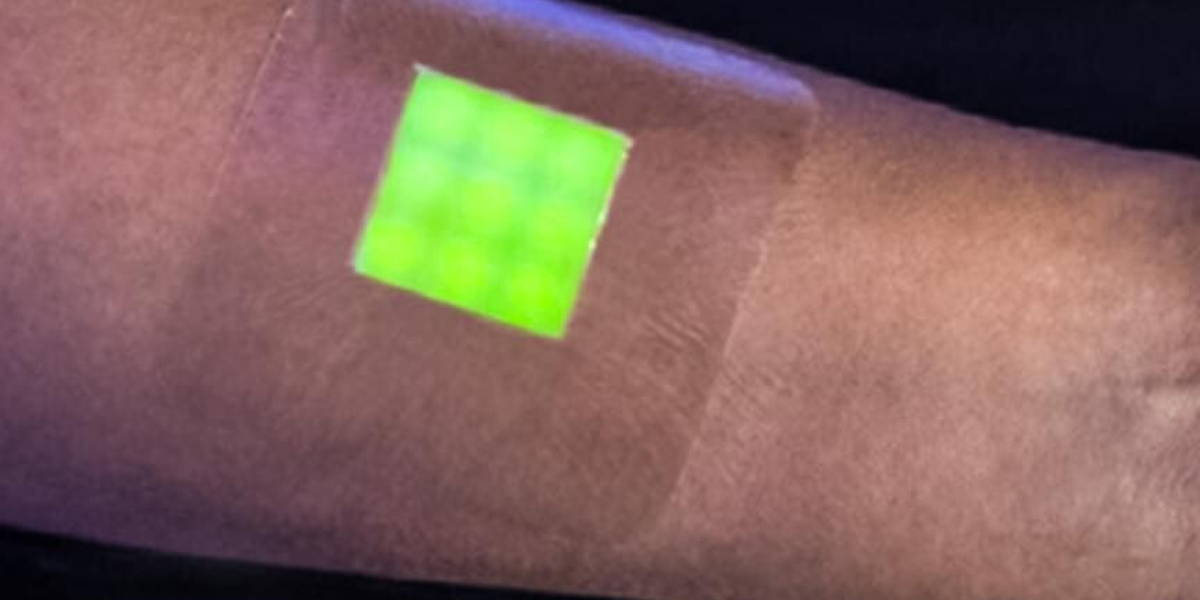 New type of dressing turns green when wound becomes infected | ICT&health