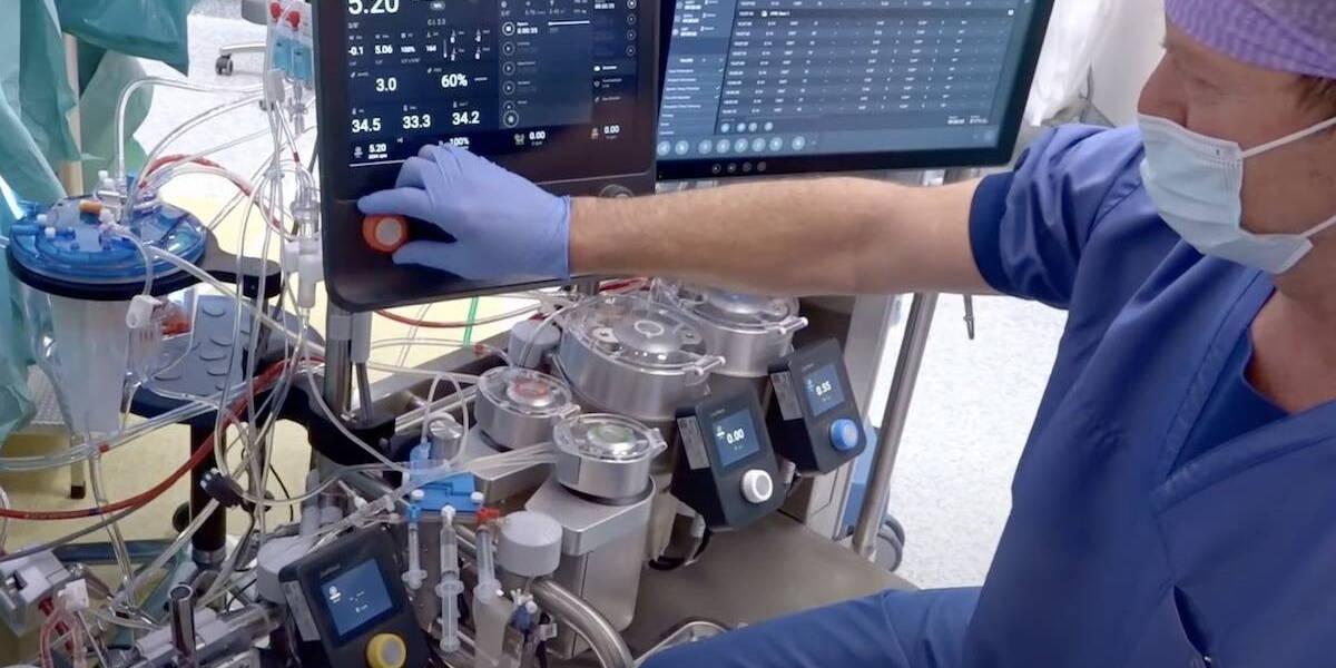 Nieuwe hart-longmachine kan realtime bloed meten | ICT&health