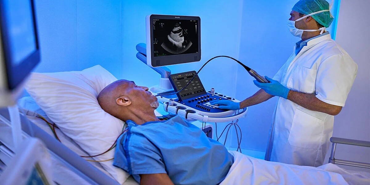AI-based ultrasound for better diagnosis of heart disease | ICT&health ...