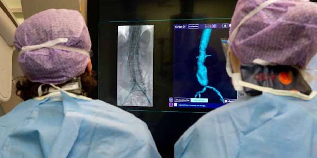 ETZ zet 3D-beeldtechnologie in voor vaatoperaties | ICT&health