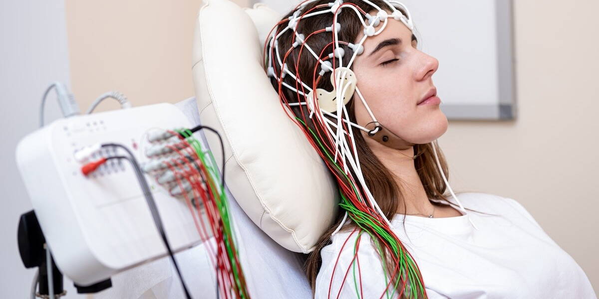 Hair-like EEG electrode could revolutionize brain monitoring | ICT&health