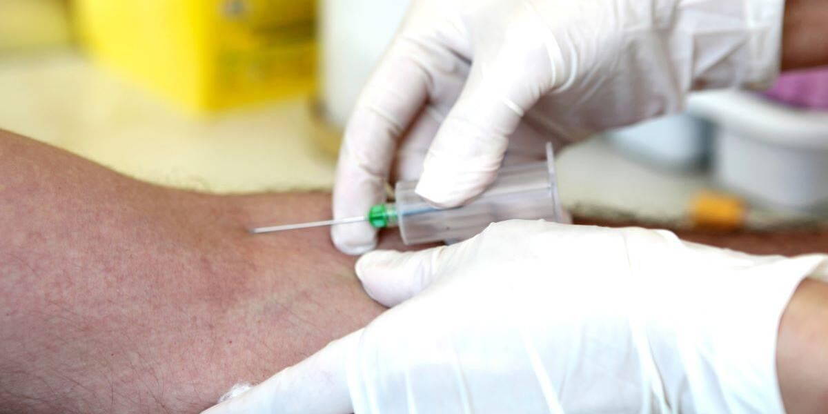 Blood test diagnoses Alzheimer's with 95% accuracy | ICT&health