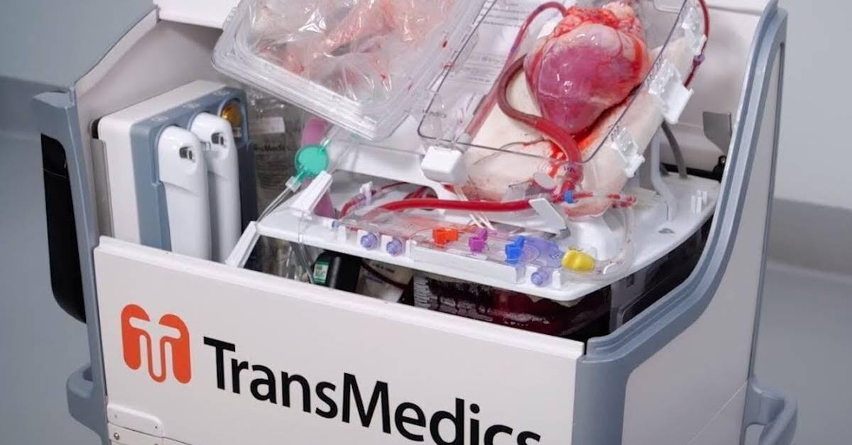 Meer harttransplantaties dankzij 'Heart-in-a-box' | ICT&health