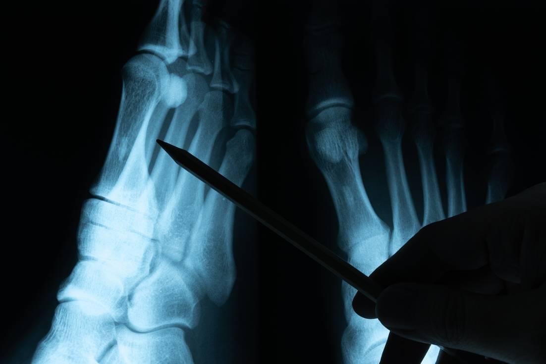 ETZ zet AI in om botbreuk te beoordelen - ICT&health | Het officiële ...