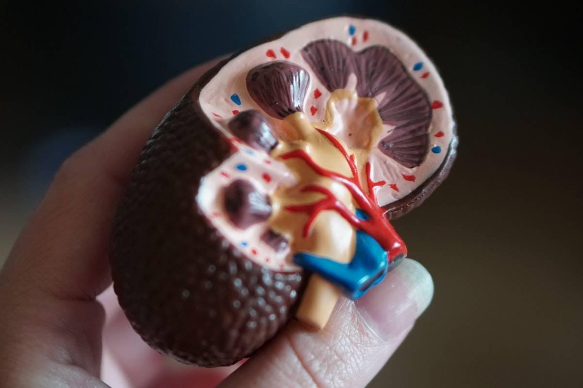 4,1 miljoen naar ontwikkeling draagbare kunstnier - ICT&health | Het ...