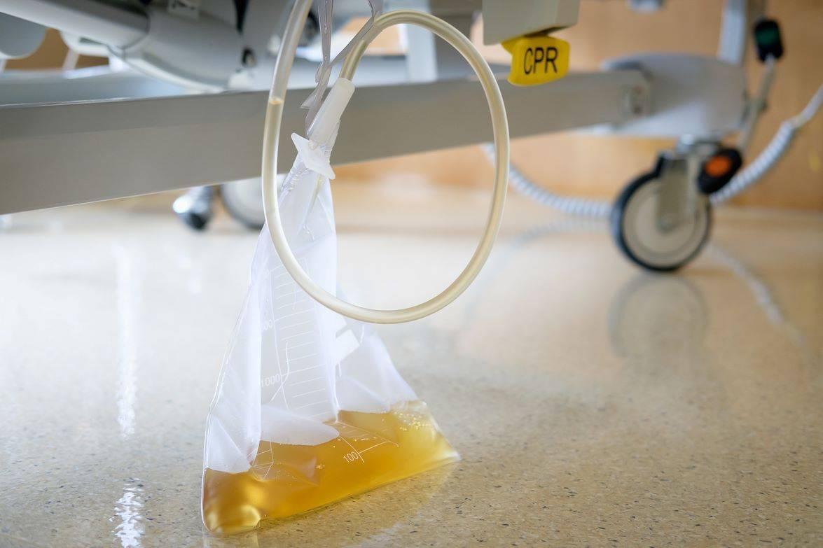 Robots en AI signaleren urineweginfectie eerder - ICT&health | Het ...