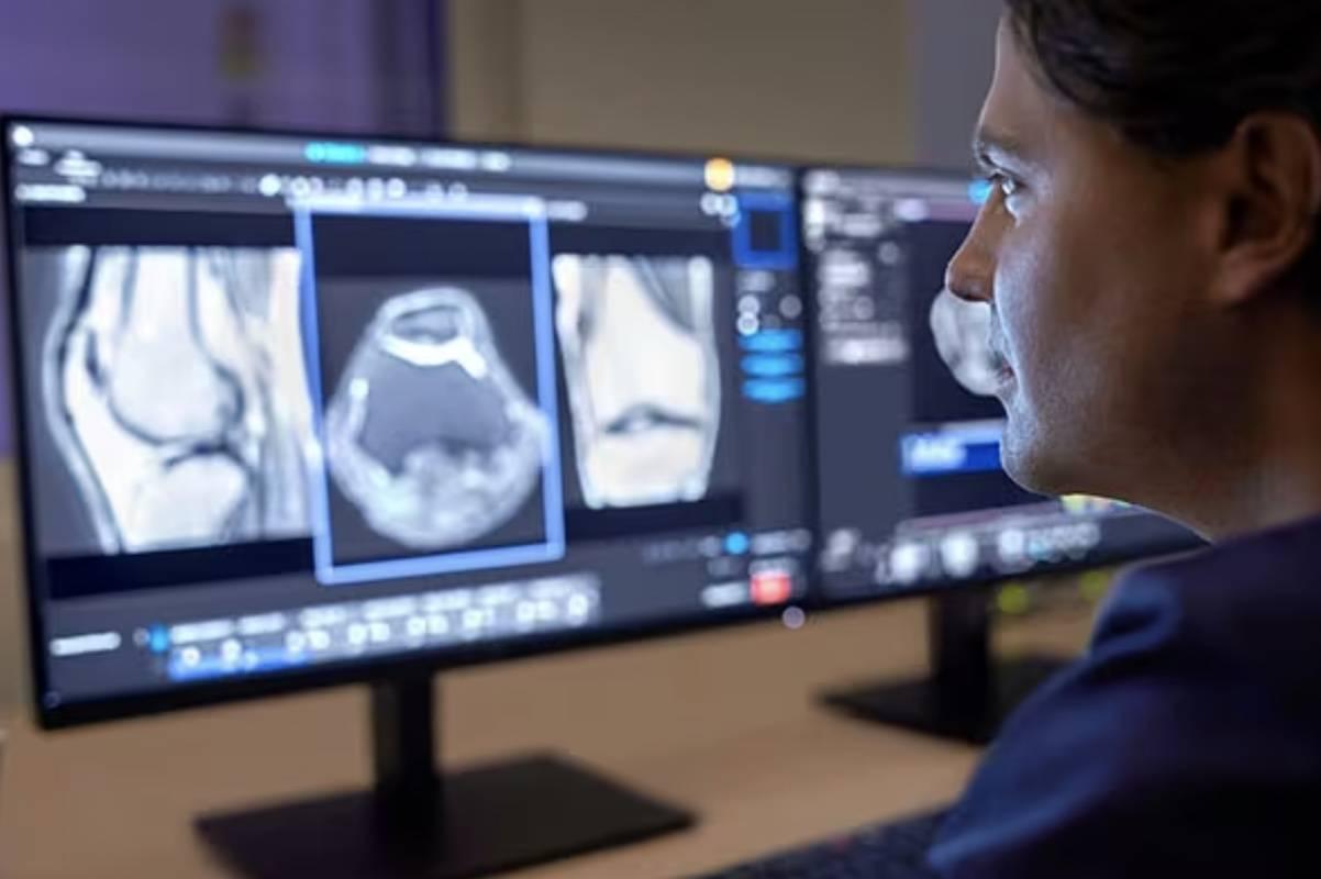 AI verbetert kwaliteit MRI-scan - ICT&health | Het officiële ...