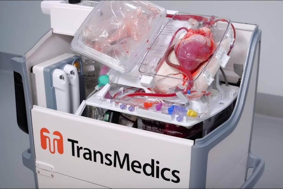Meer harttransplantaties dankzij 'Heart-in-a-box' - ICT&health | Het ...