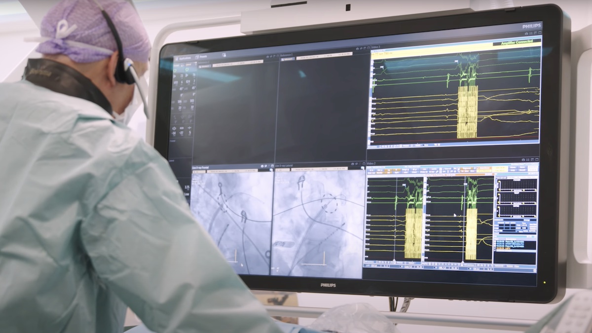 Boezemfibrilleren bestrijden met nieuwe techniek - ICT&health | Het ...